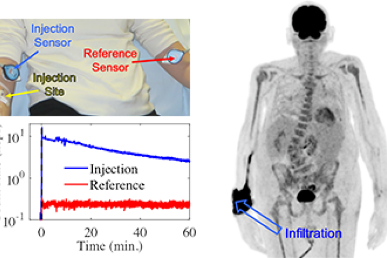 Radiotracer Infiltration Severity Classification From Topical Sensors ...