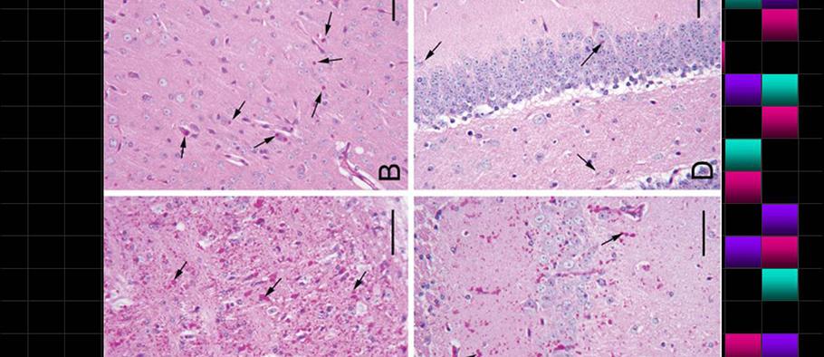 Research | Minassian Lab | UT Southwestern, Dallas, Texas