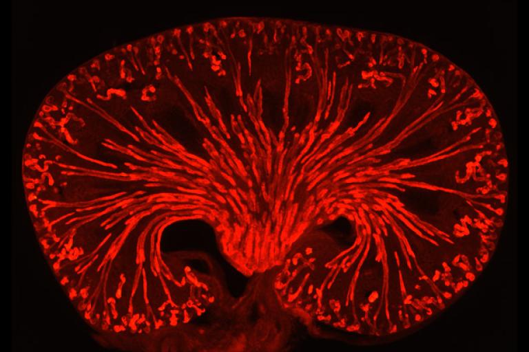 Research Projects | Marciano Lab | UT Southwestern, Dallas, Texas