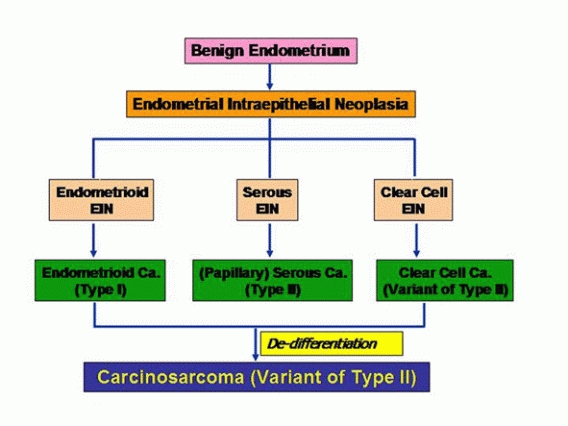 Precursors of Type II Endometrial Cancer | Zheng Lab | UT Southwestern ...