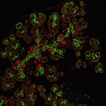 Pancreatic Progenitor Epithelium | Cleaver Lab | UT Southwestern ...