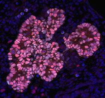 Pancreatic Progenitor Epithelium | Cleaver Lab | UT Southwestern ...