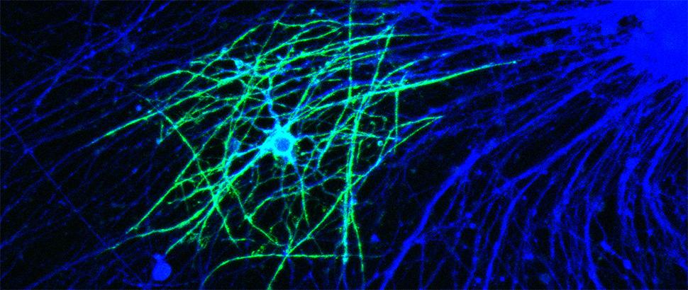 Sun (Lu) Lab | UT Southwestern, Dallas, Texas