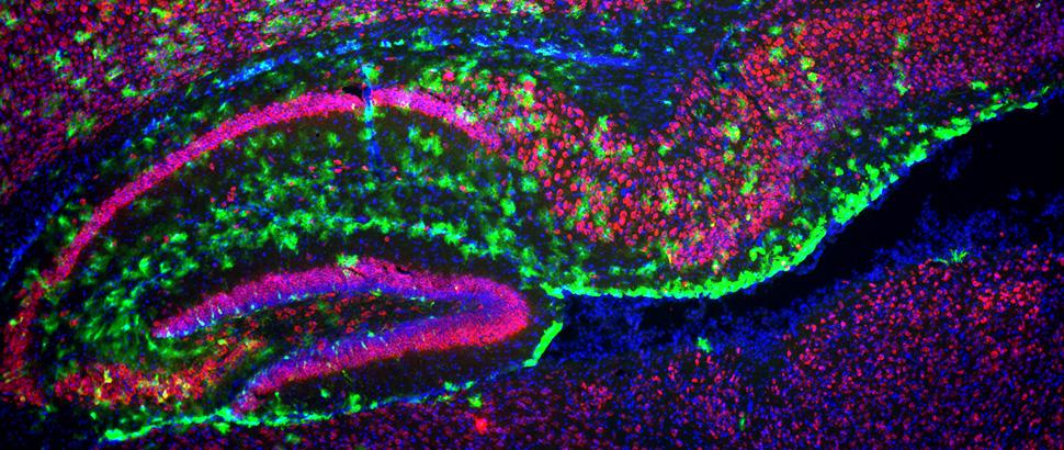 Sun (Lu) Lab | UT Southwestern, Dallas, Texas