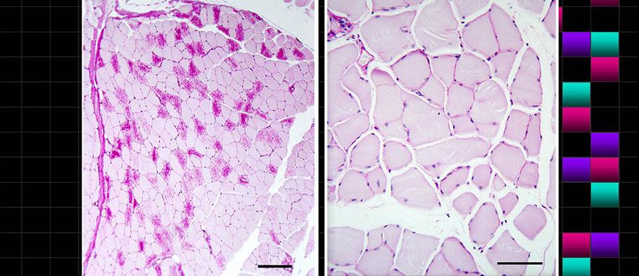 Research | Minassian Lab | UT Southwestern, Dallas, Texas