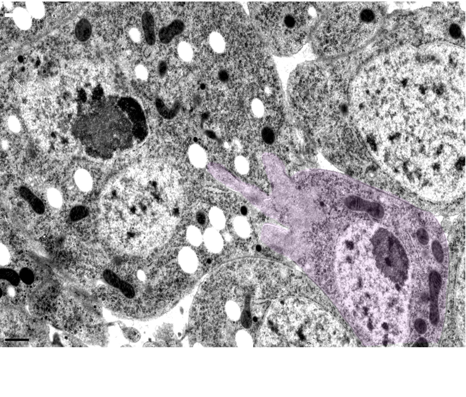 Chen (Elizabeth) Lab | UT Southwestern, Dallas, Texas