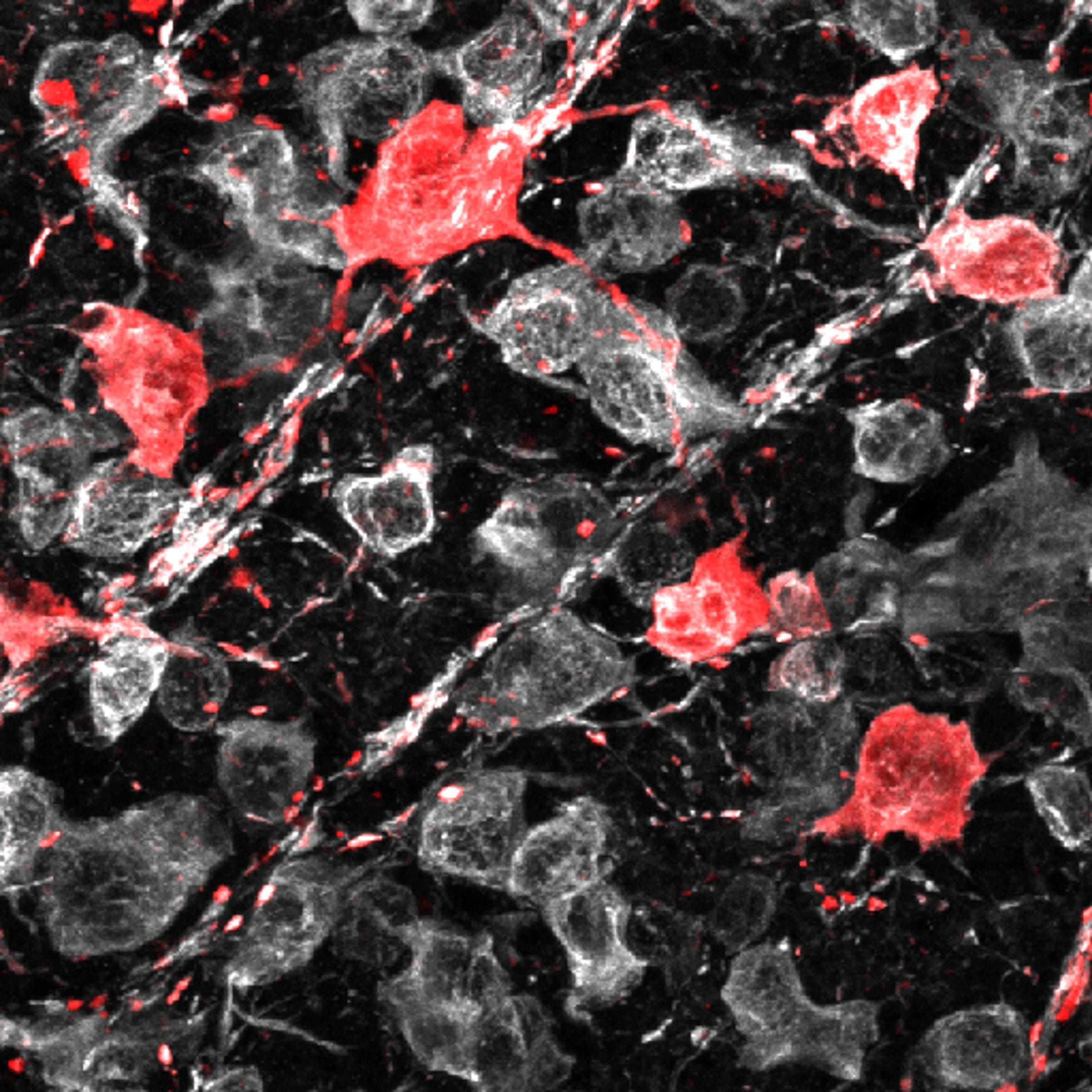 Research | Park (Kevin) Lab | UT Southwestern, Dallas, Texas